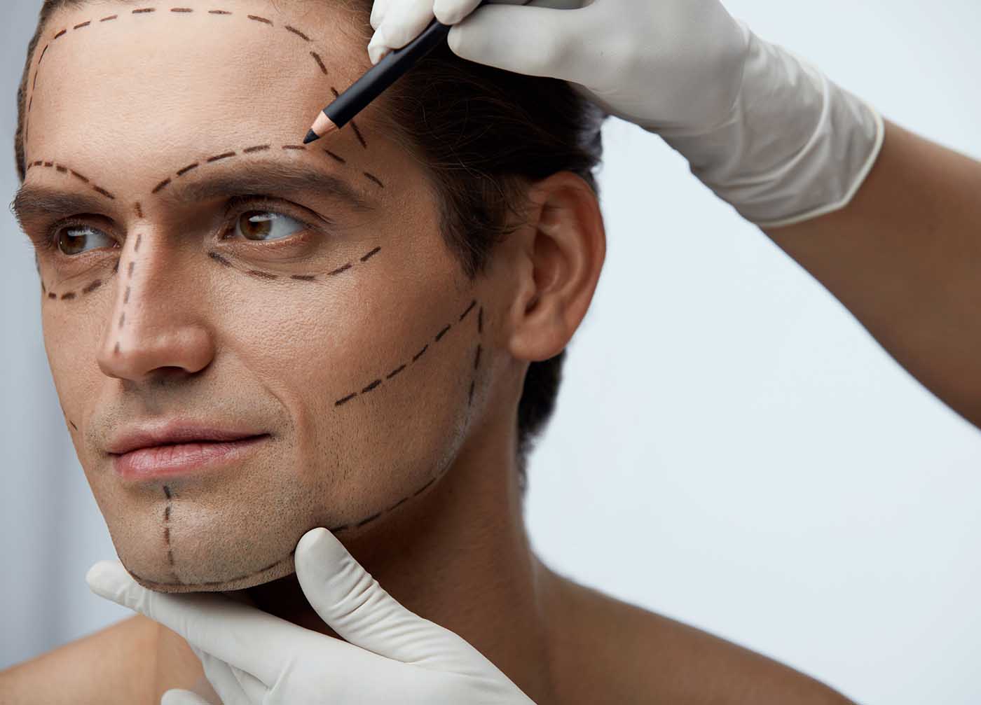 Chirurgie esthétique Homme / Lifting Cervico Facial, visage et cou ...